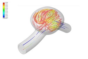 Flow Visualization of Arteries | Flometrics